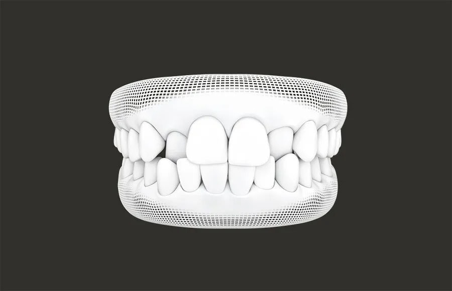 Invisalign Damansara Uptown | Clear Aligners by Experts
