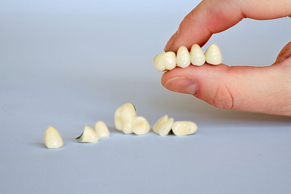 Crown and Bridges - Resmile Dental